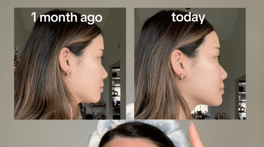 Tapeher Mouth Tape For Better Sleep Stop Snoring Improve Jawline 9590